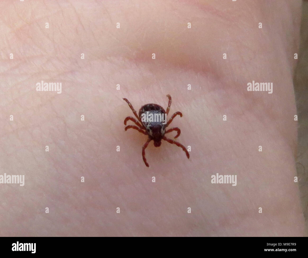 American dog tick hi-res stock photography and images - Alamy