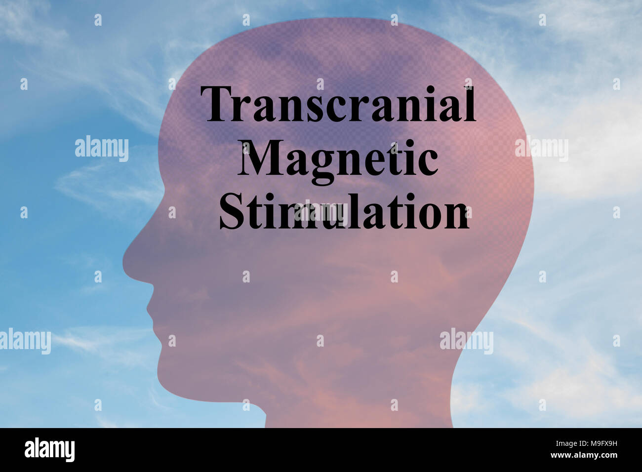 Render illustration of Transcranial Magnetic Stimulation title on head silhouette, with cloudy ...