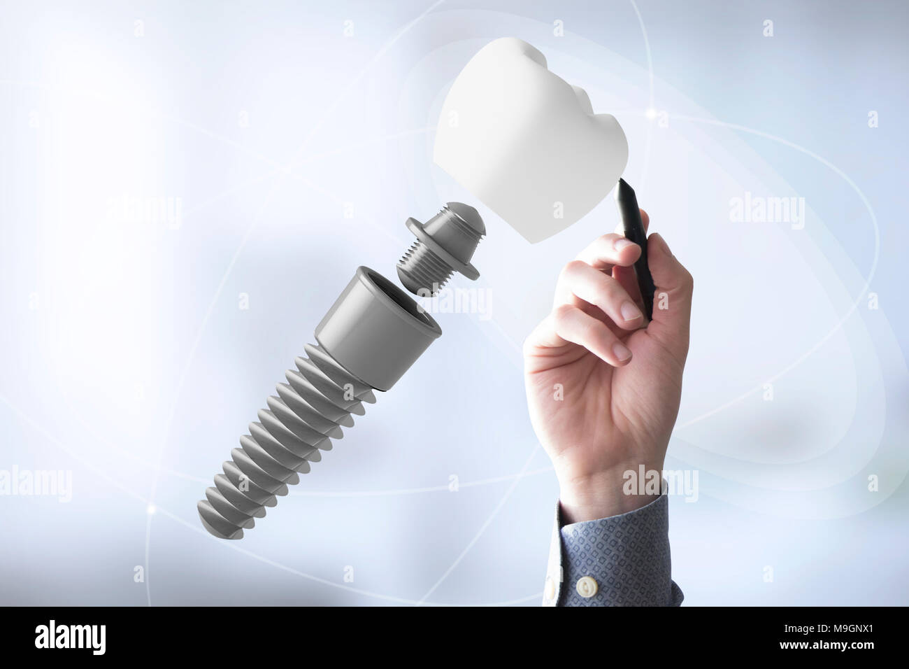 Dental prosthesis design hi-res stock photography and images - Alamy