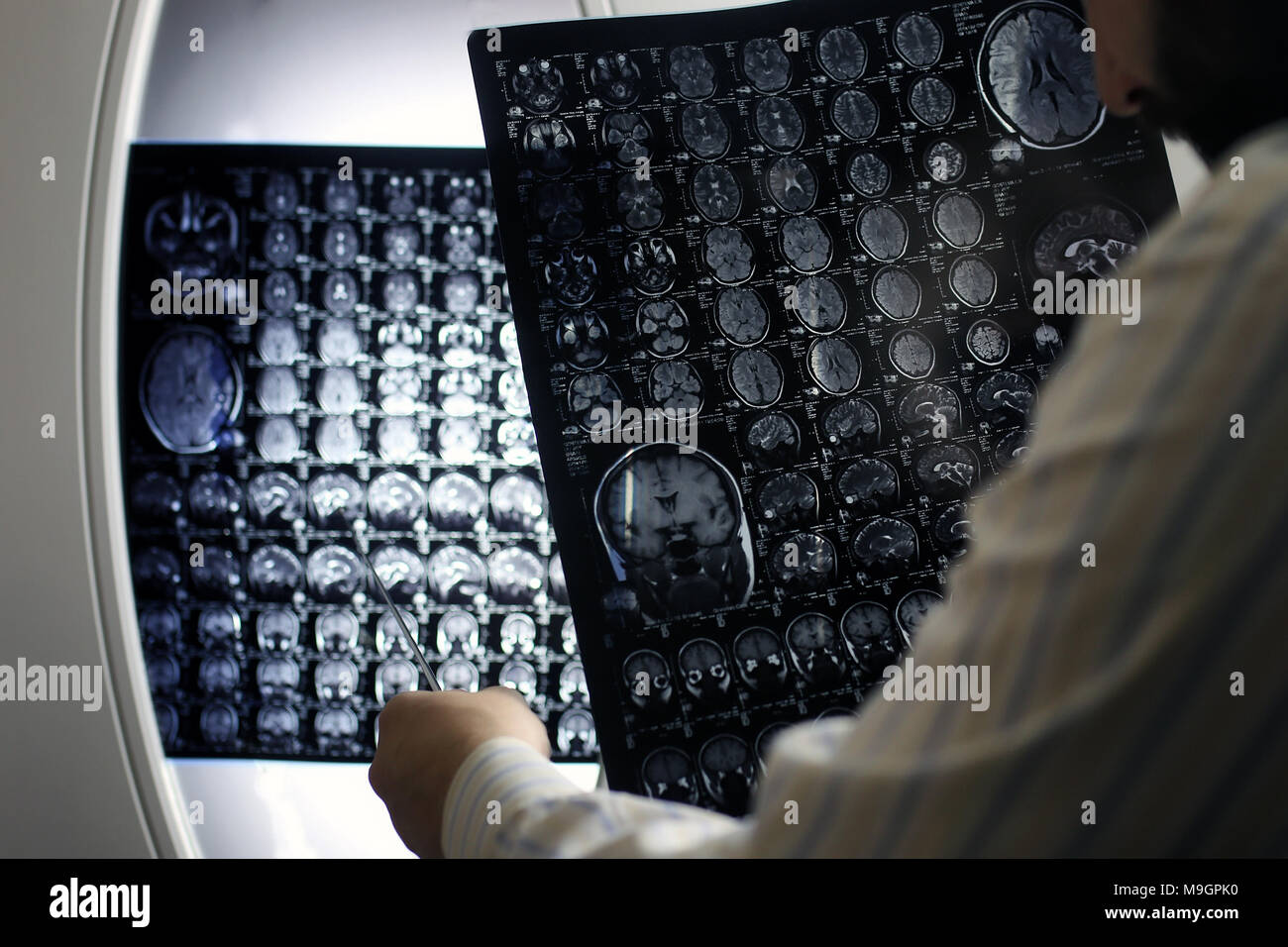 Doctor holding picture brain hi-res stock photography and images - Alamy