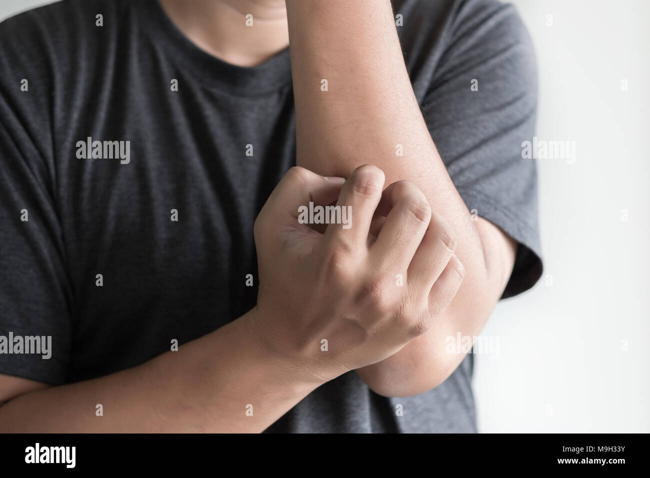 itchy arms scratching Healthcare And Medicine Health problem Stock ...