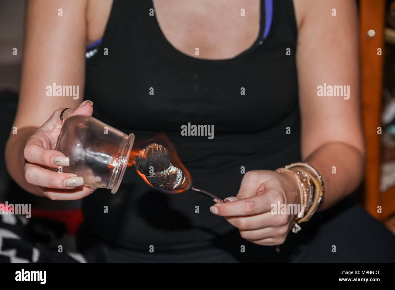 Fire cupping woman hi-res stock photography and images - Alamy