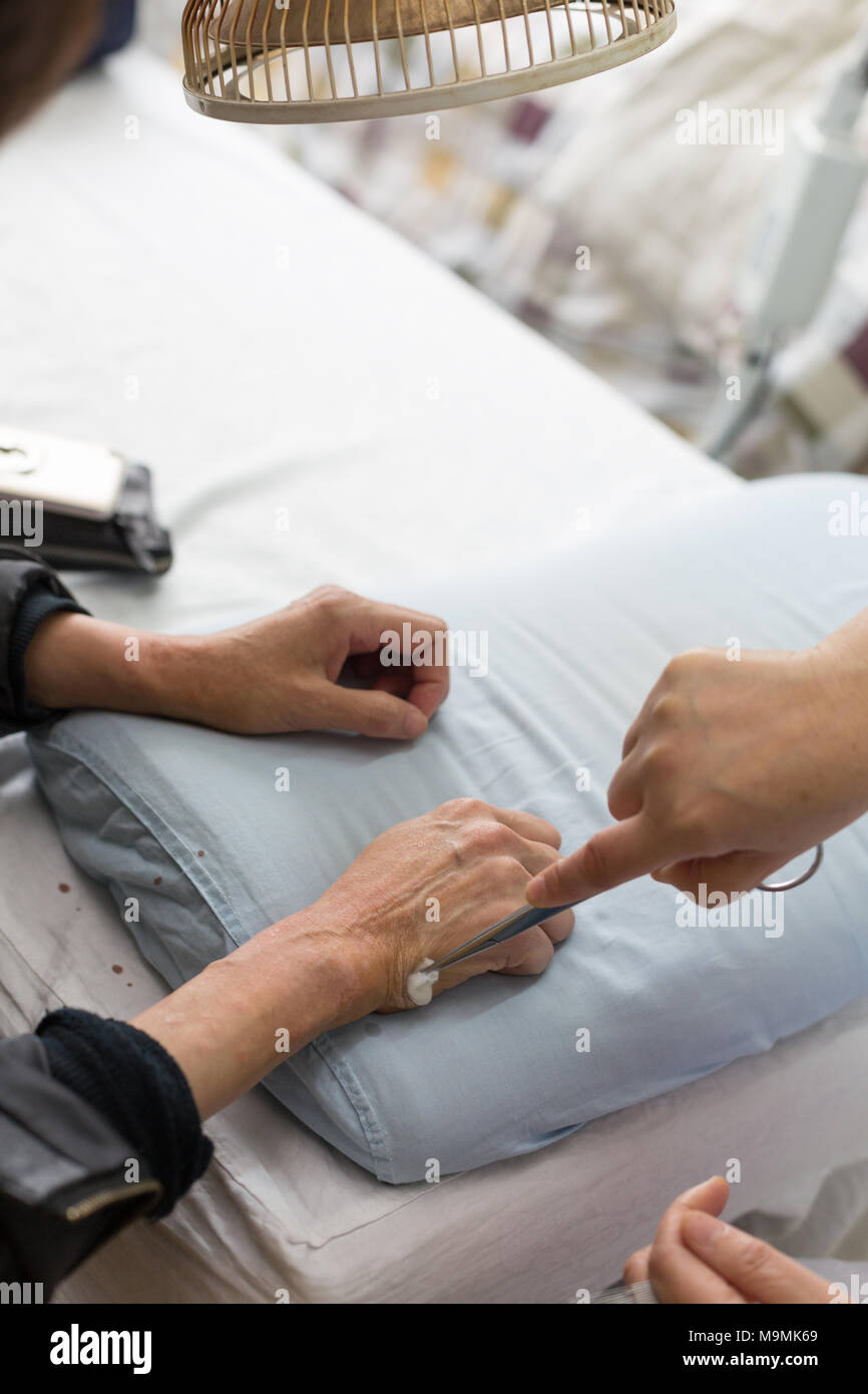 Acupuncture scene at a clinic in China Stock Photo - Alamy