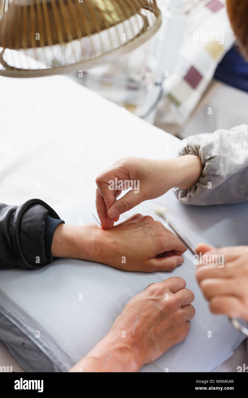 Acupuncture scene at a clinic in China Stock Photo - Alamy
