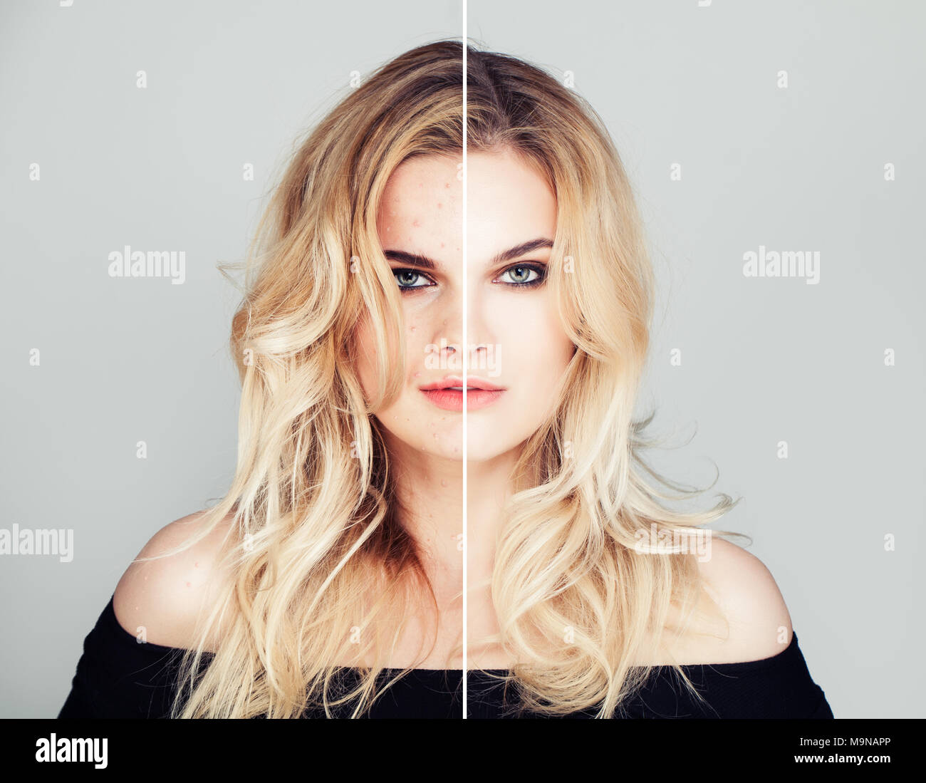 Portrait unhealthy hi-res stock photography and images - Alamy