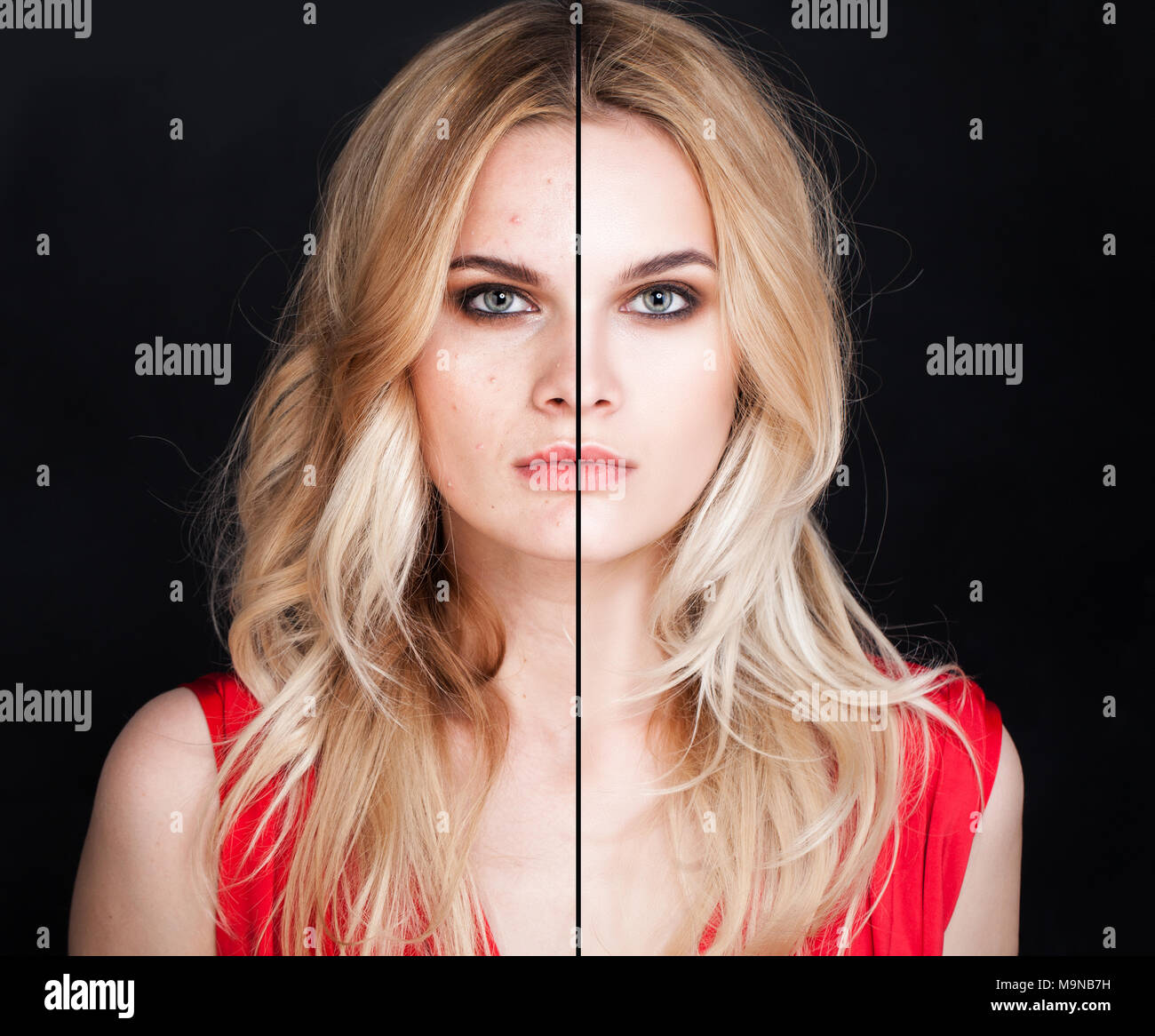 Young Woman with Skin Problem and Clear Skin Female Face Closeup ...