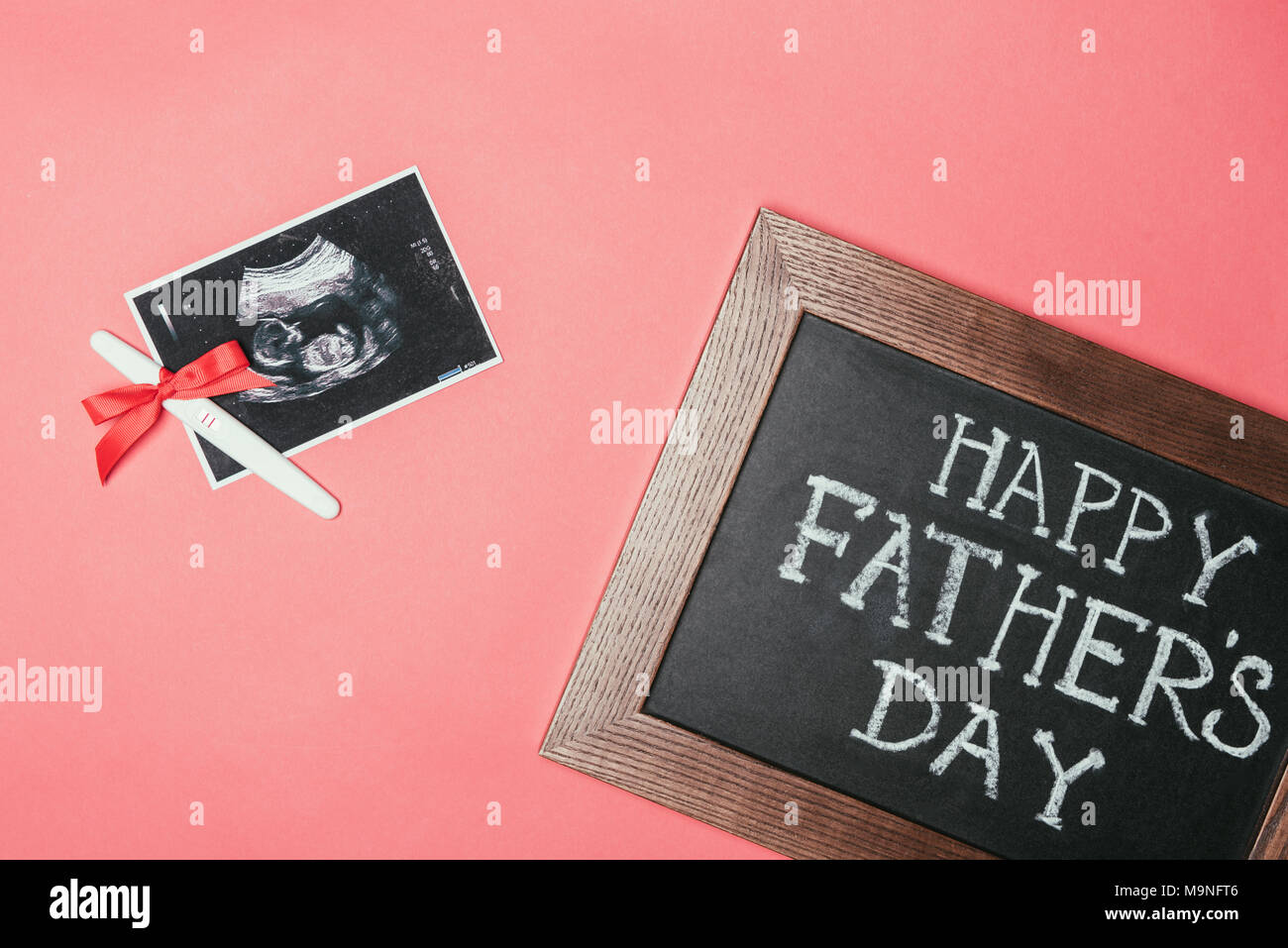 top view of happy fathers day blackboard, ultrasound scan and pregnancy ...