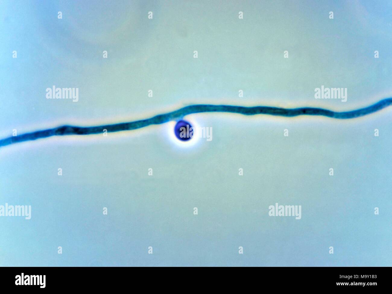 Conidium hi-res stock photography and images - Alamy