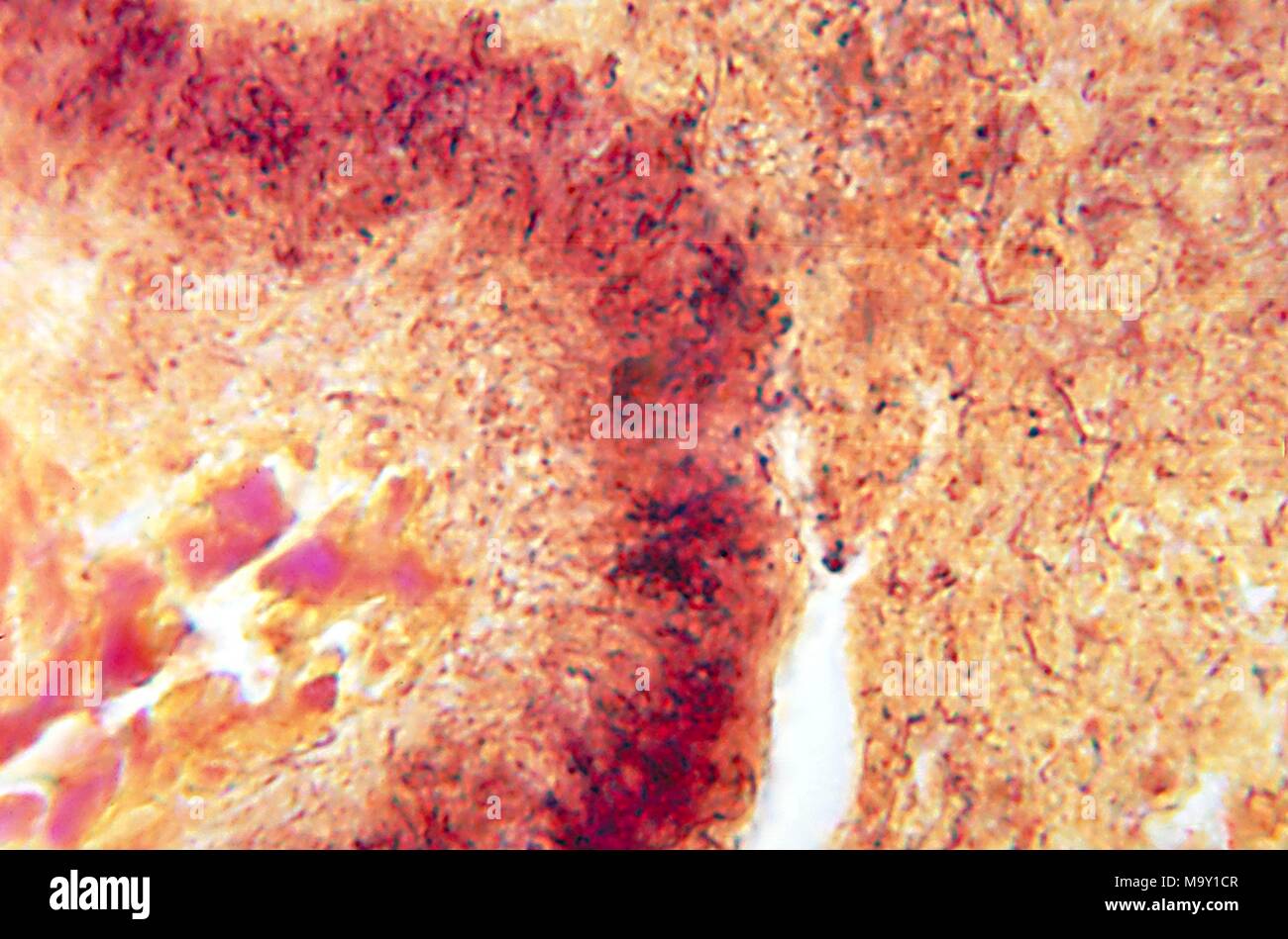 Propionibacterium propionicus hi-res stock photography and images - Alamy