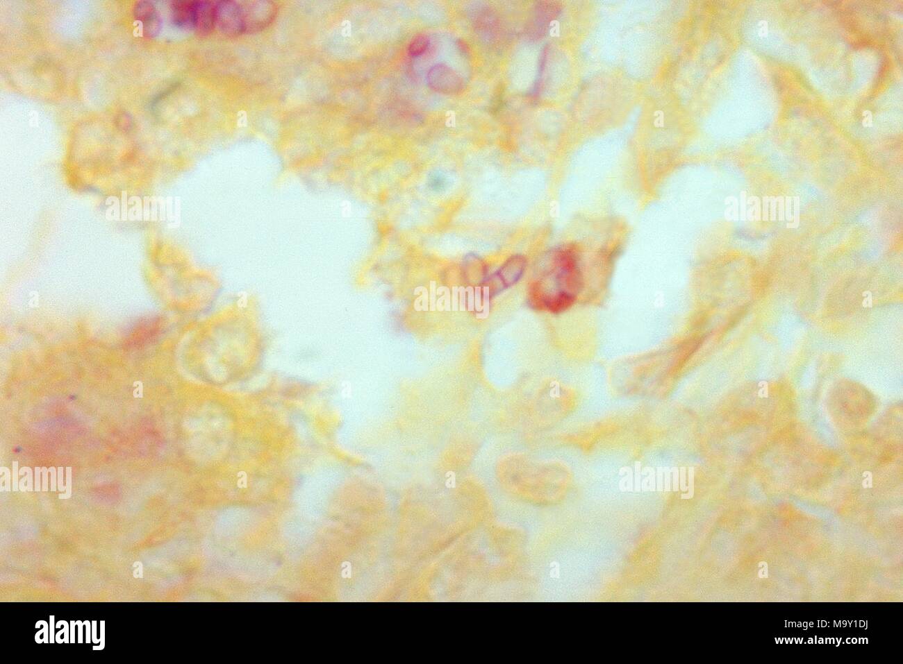 Human testicle hi-res stock photography and images - Alamy