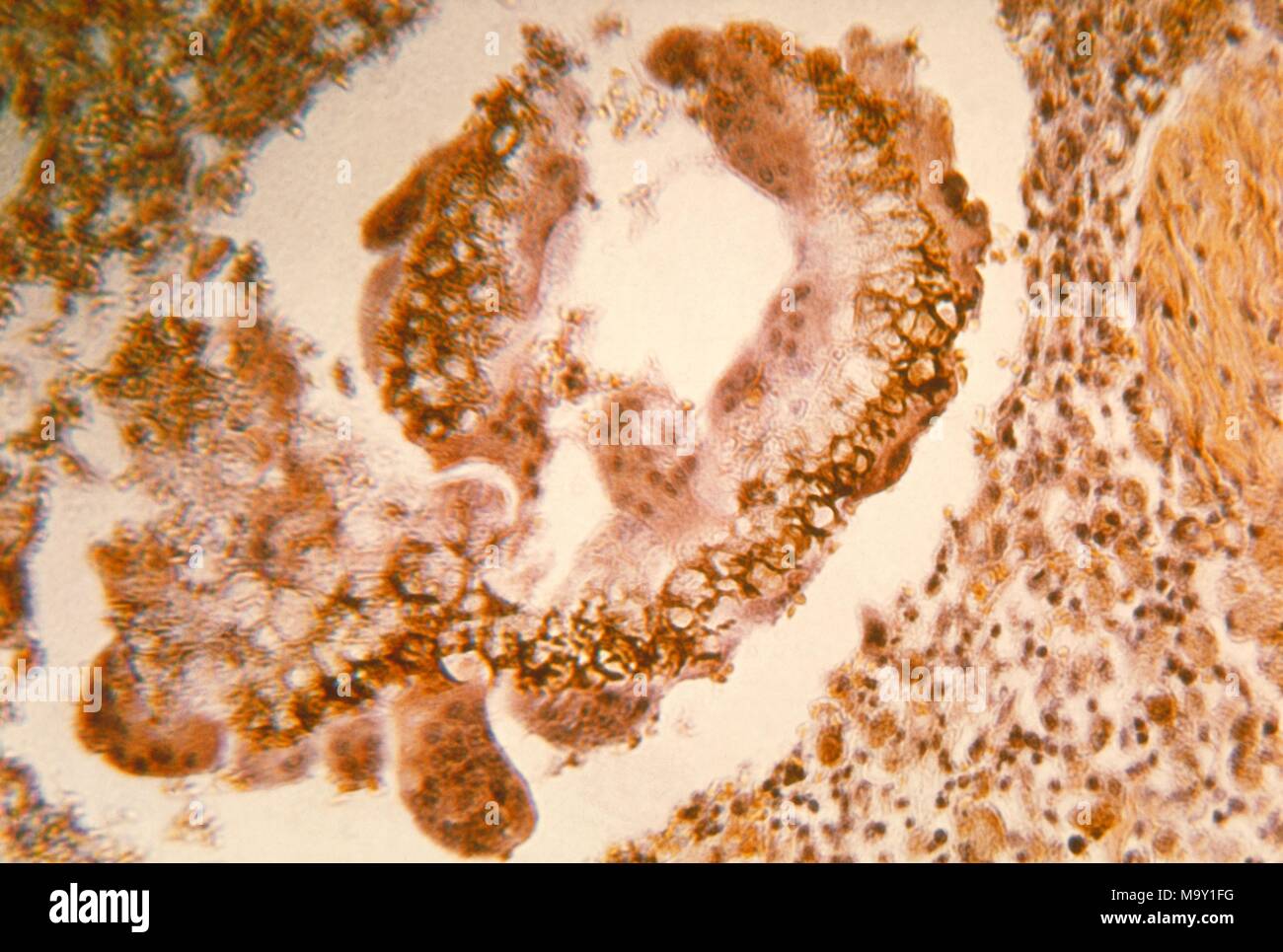 Curvularia hi-res stock photography and images - Alamy