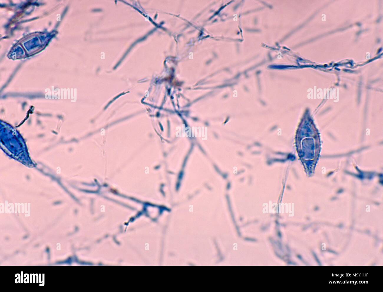 Zoophilic fungus microsporum hi-res stock photography and images - Alamy