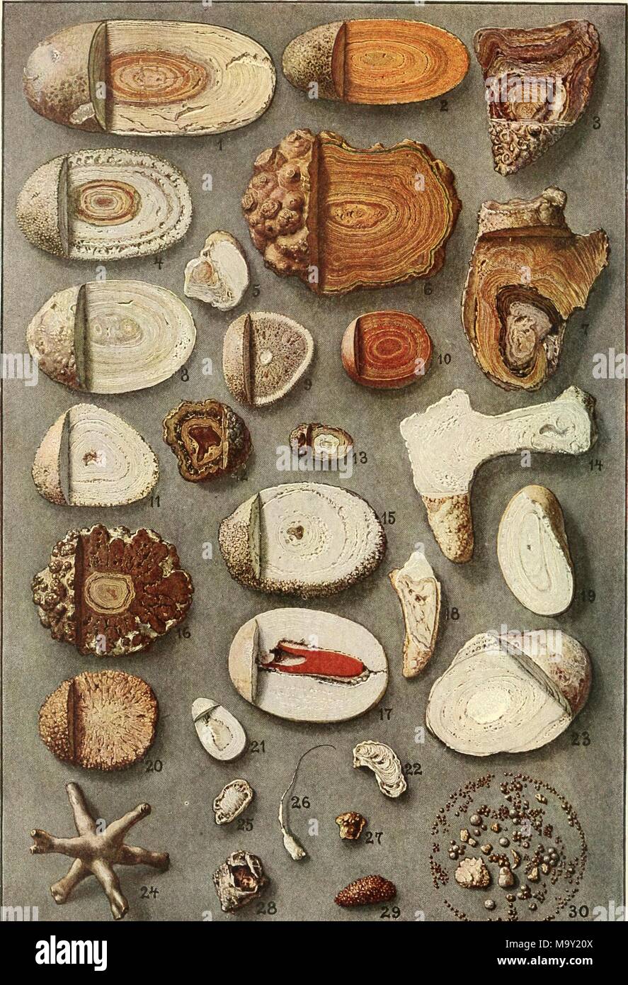 Color illustration depicting 30 numbered examples of kidney and bladder ...