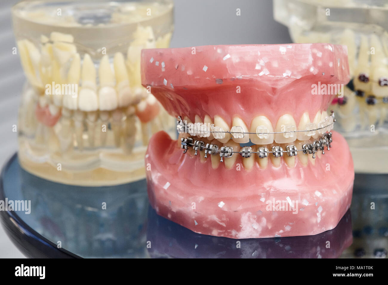 Miley Cyrus Overbite