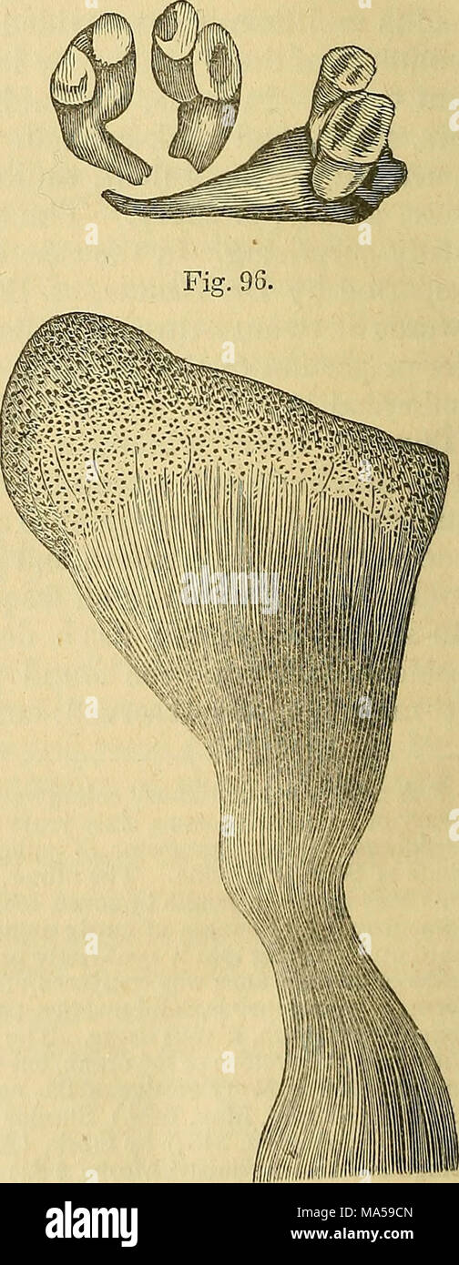. Elements of pathological anatomy Stock Photo - Alamy