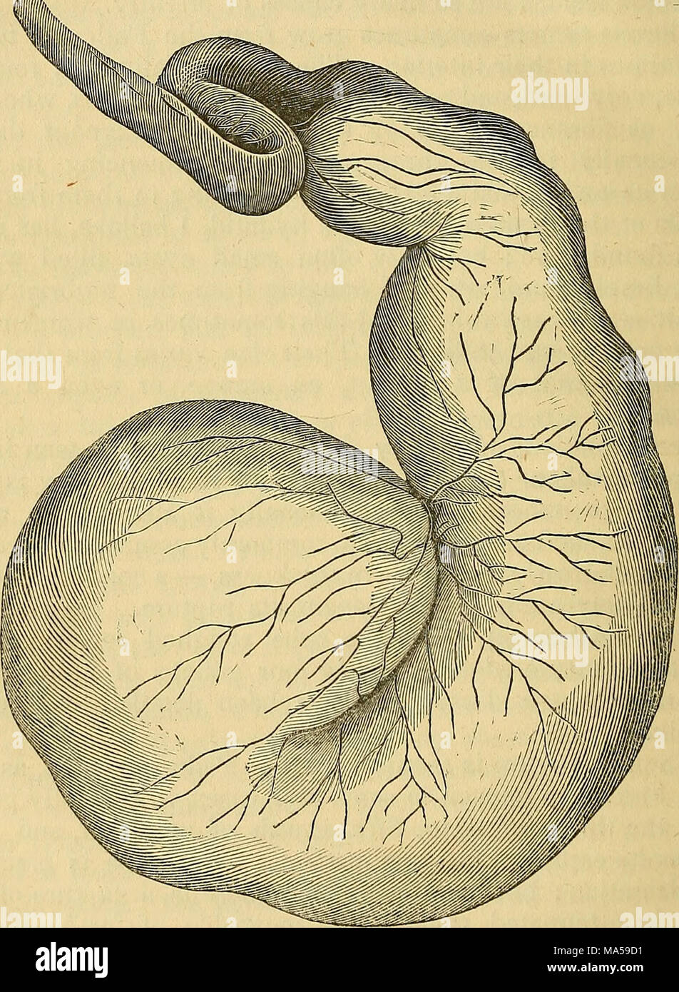 . Elements of pathological anatomy Stock Photo - Alamy