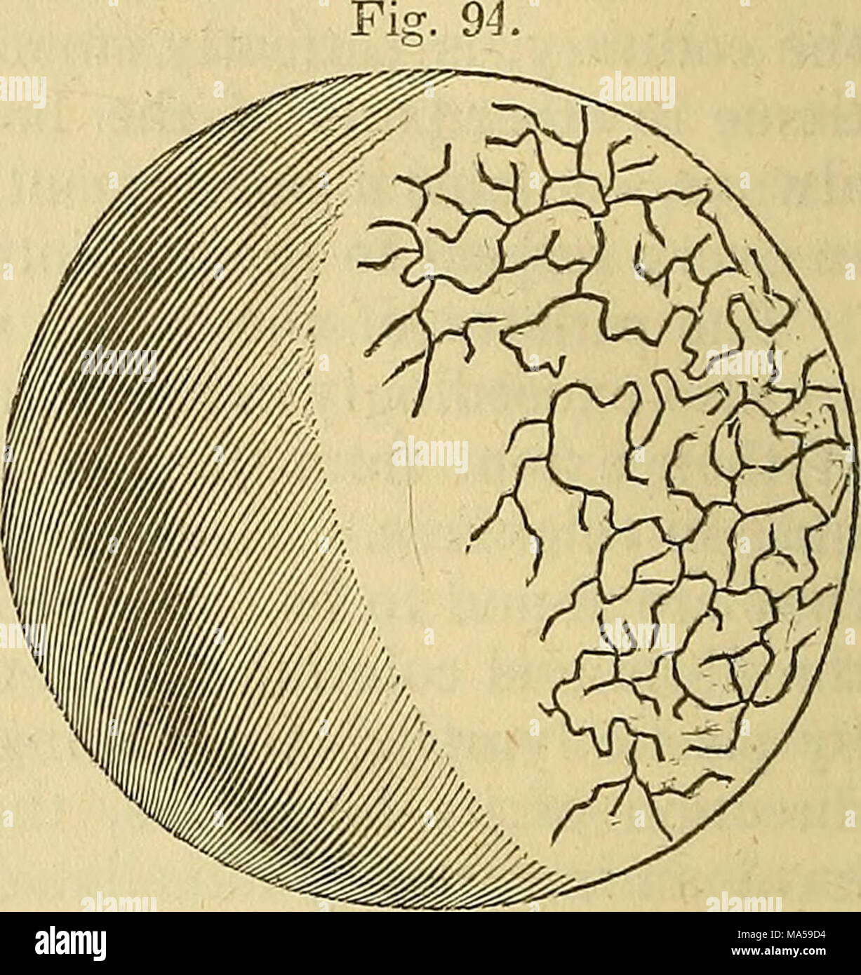 . Elements of pathological anatomy Stock Photo - Alamy
