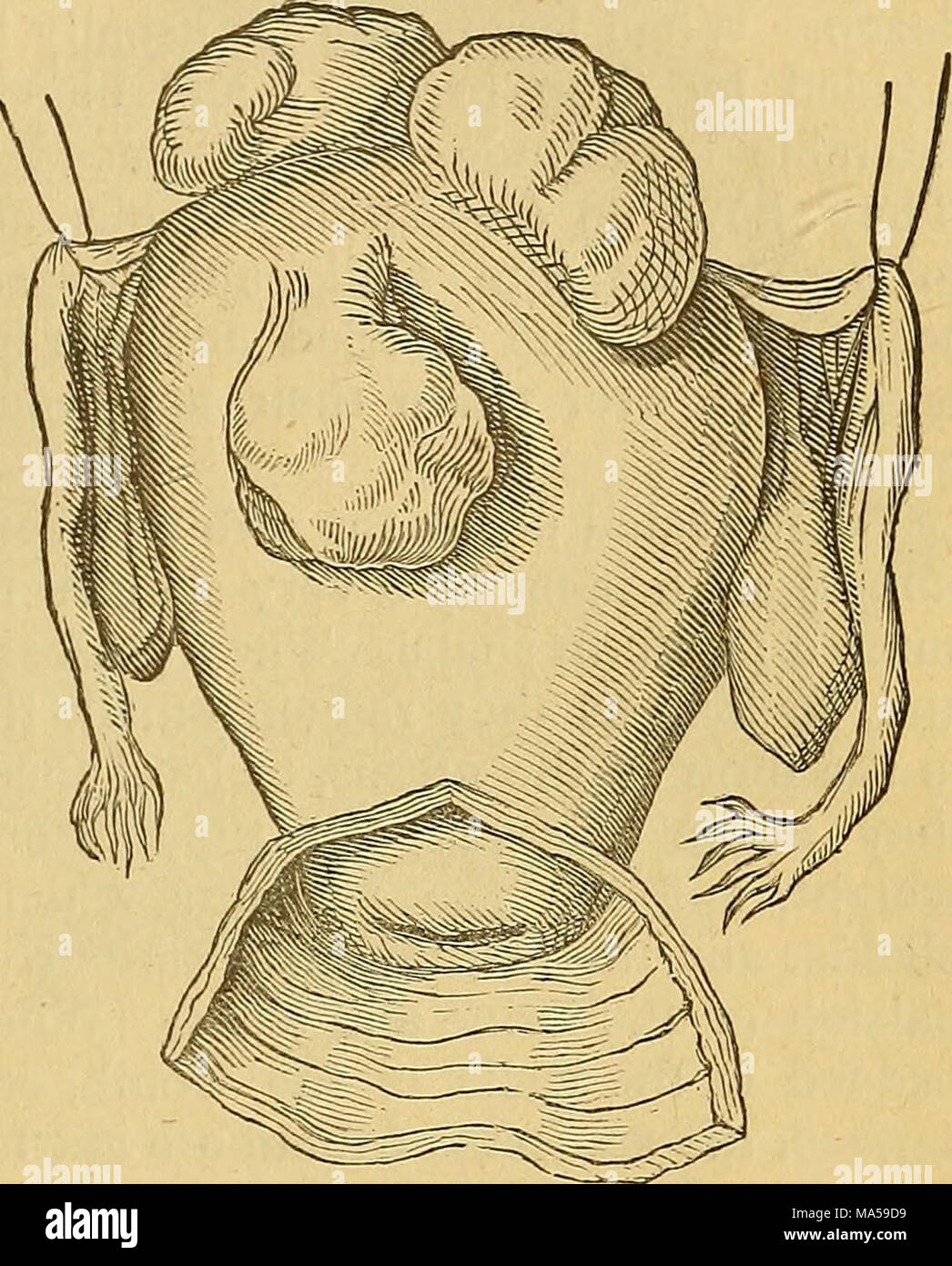 . Elements of pathological anatomy Stock Photo - Alamy