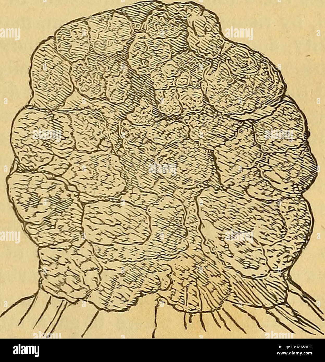 . Elements of pathological anatomy Stock Photo - Alamy