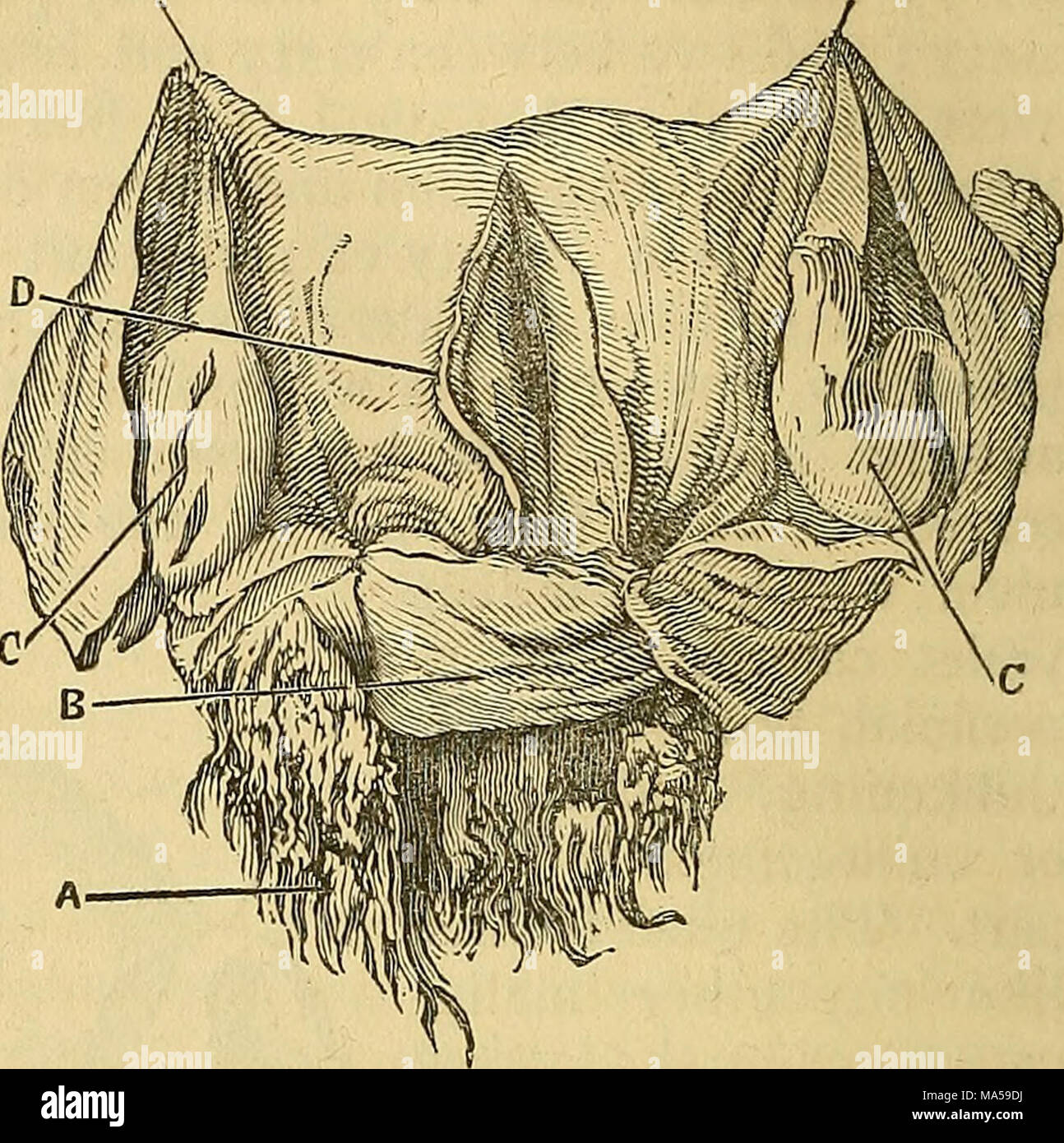 . Elements of pathological anatomy Stock Photo - Alamy