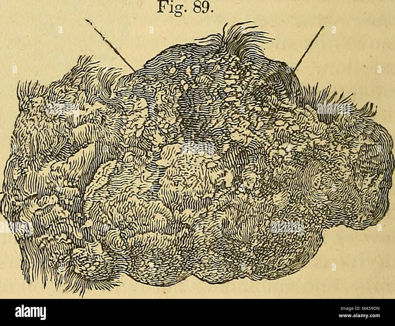 . Elements of pathological anatomy Stock Photo - Alamy