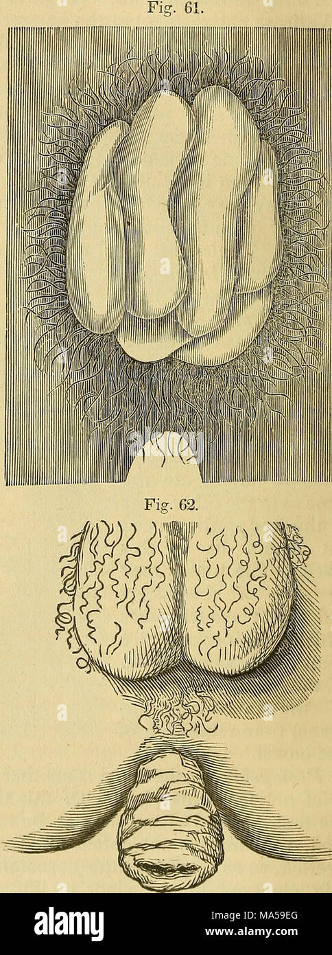 . Elements of pathological anatomy Stock Photo - Alamy