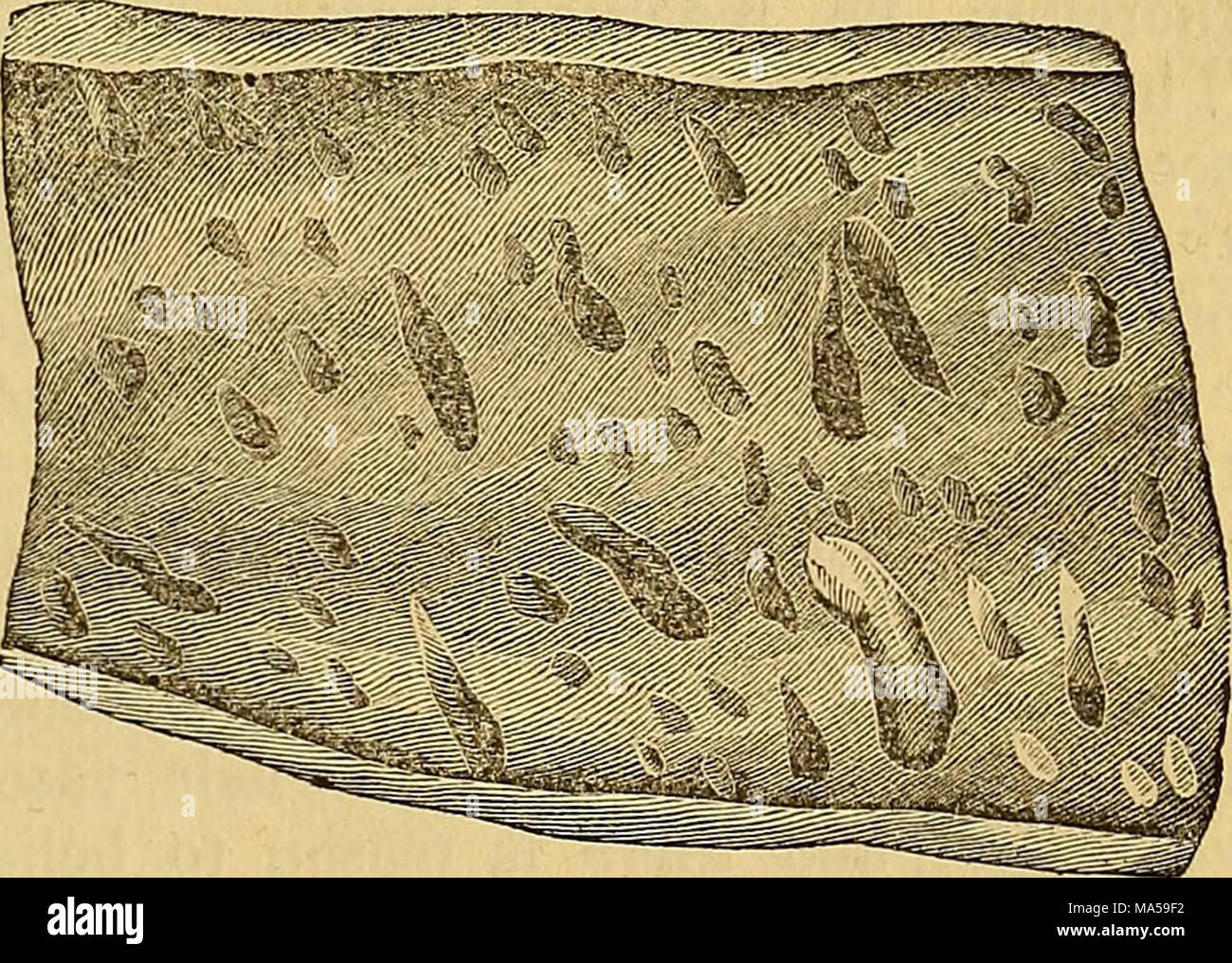 . Elements of pathological anatomy Stock Photo - Alamy