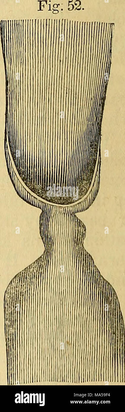 . Elements of pathological anatomy Stock Photo - Alamy