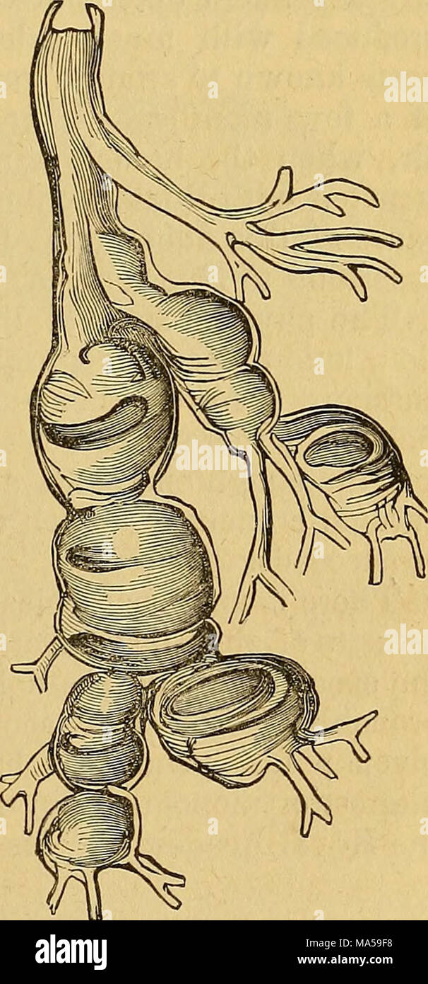 . Elements of pathological anatomy Stock Photo - Alamy