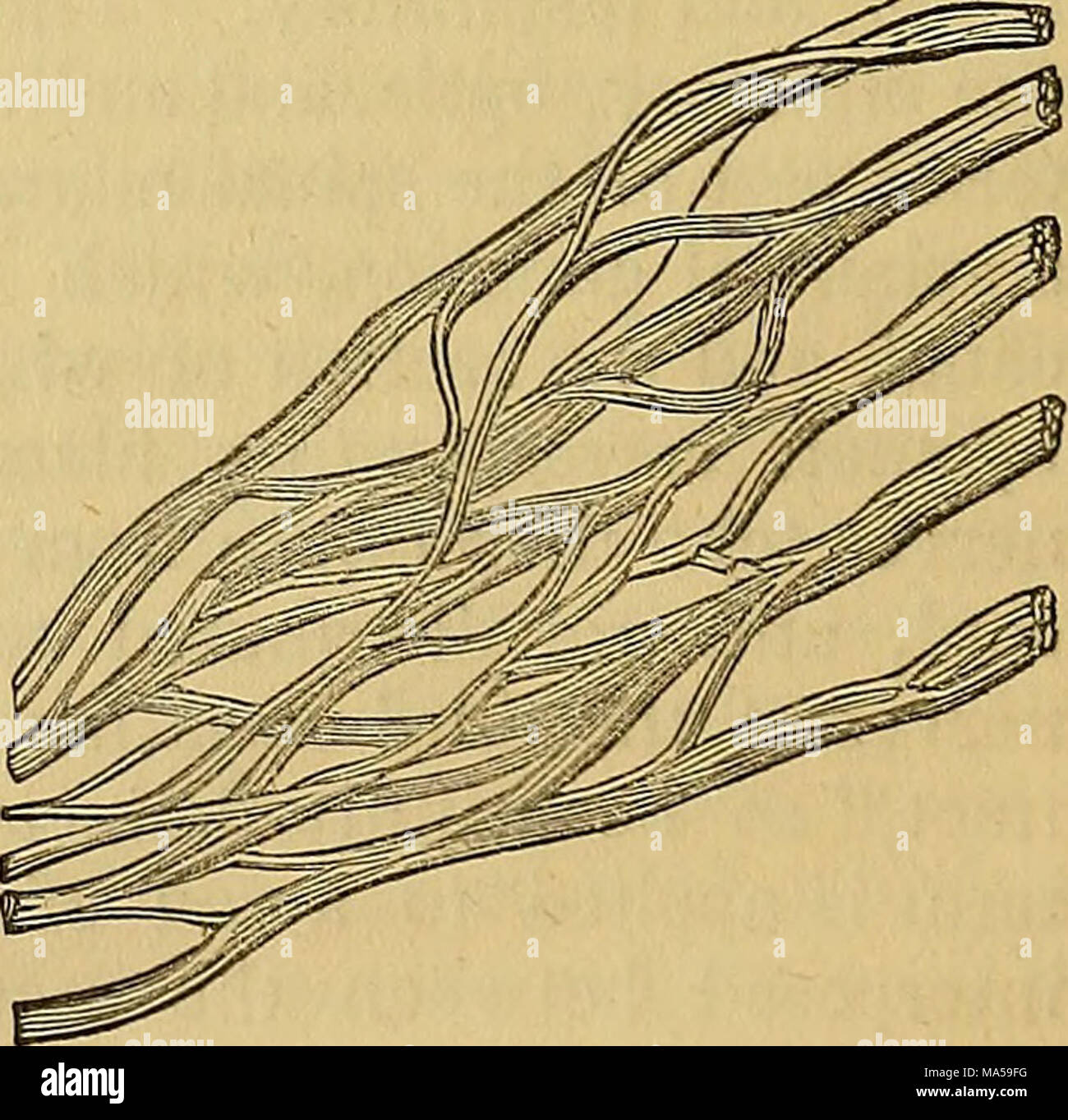 . Elements of pathological anatomy Stock Photo - Alamy