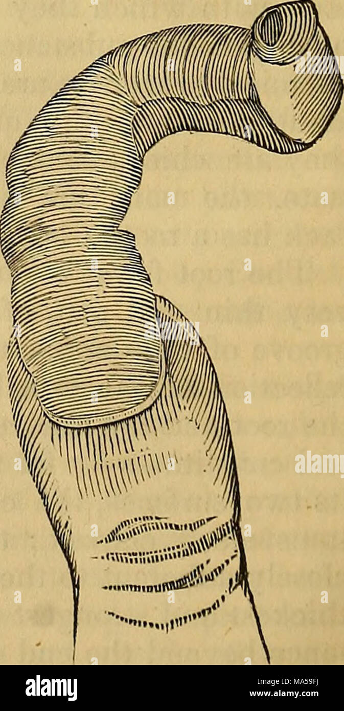 . Elements of pathological anatomy Stock Photo - Alamy