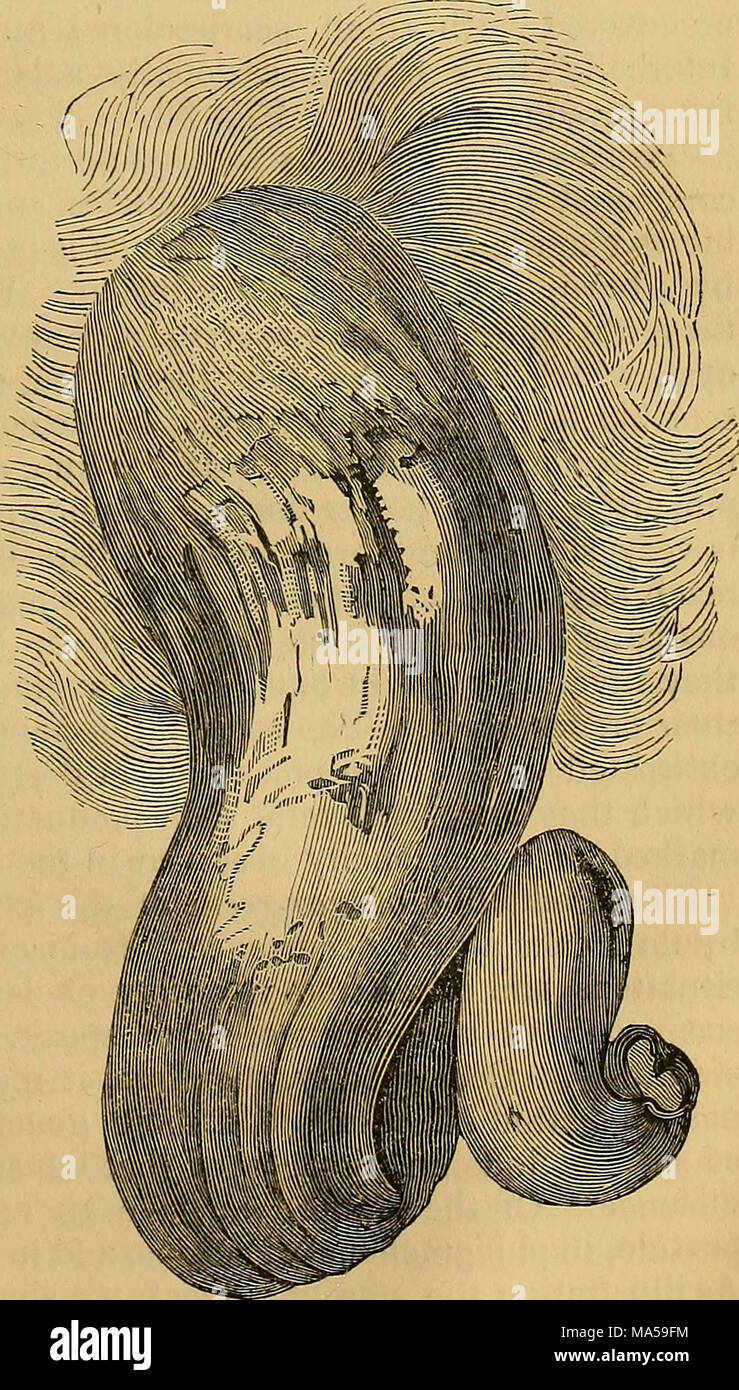 . Elements of pathological anatomy Stock Photo - Alamy