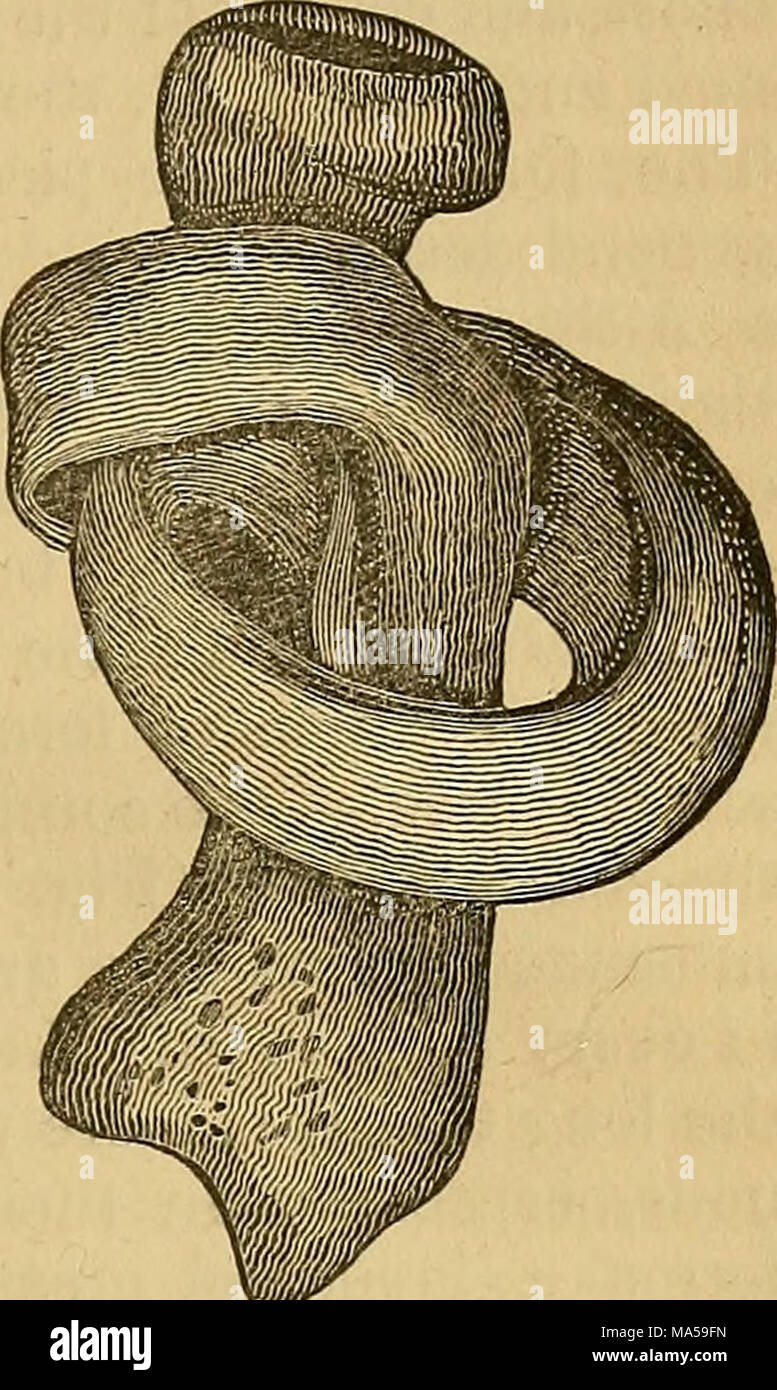 . Elements of pathological anatomy Stock Photo - Alamy