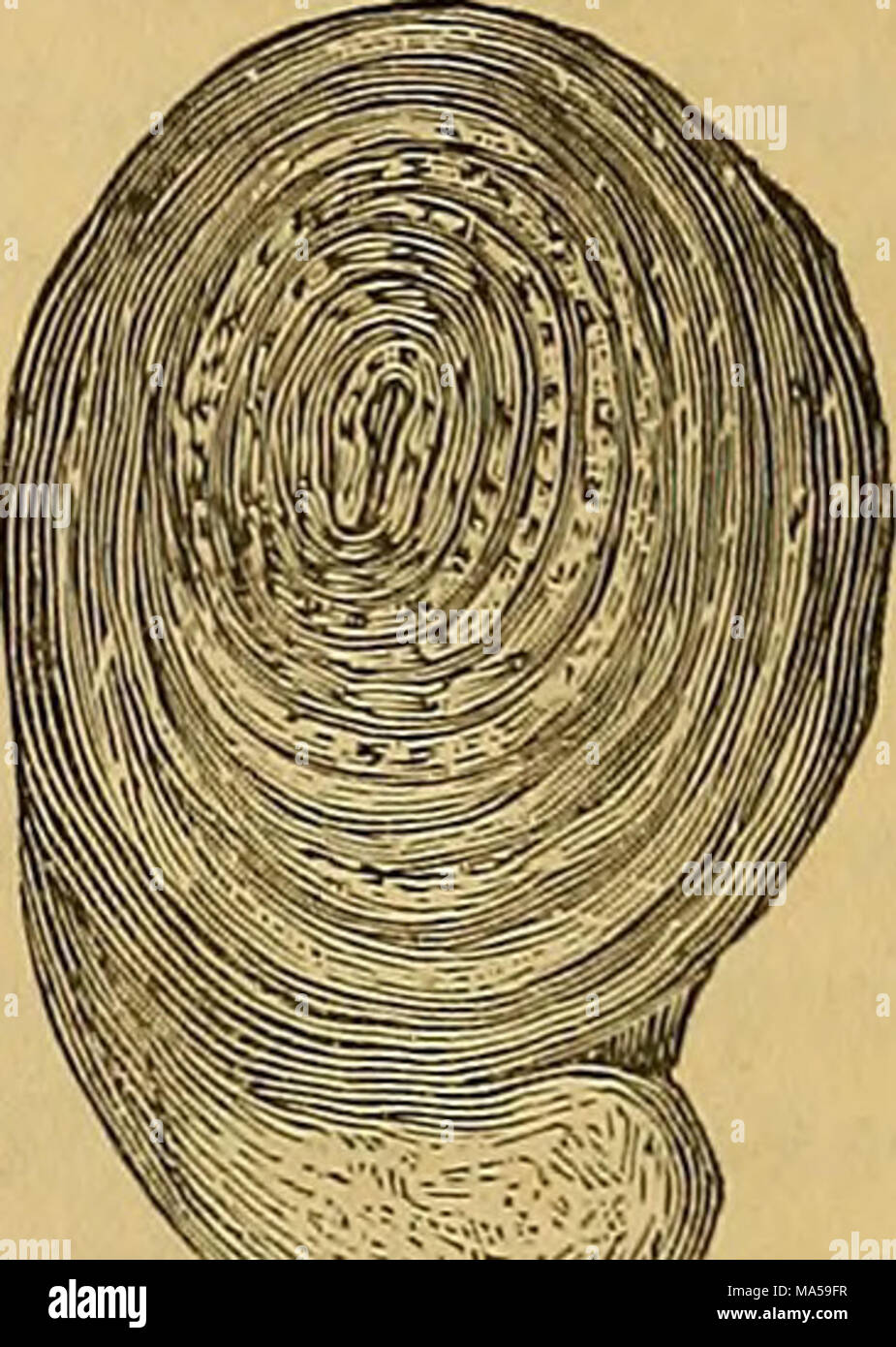 . Elements of pathological anatomy Stock Photo - Alamy