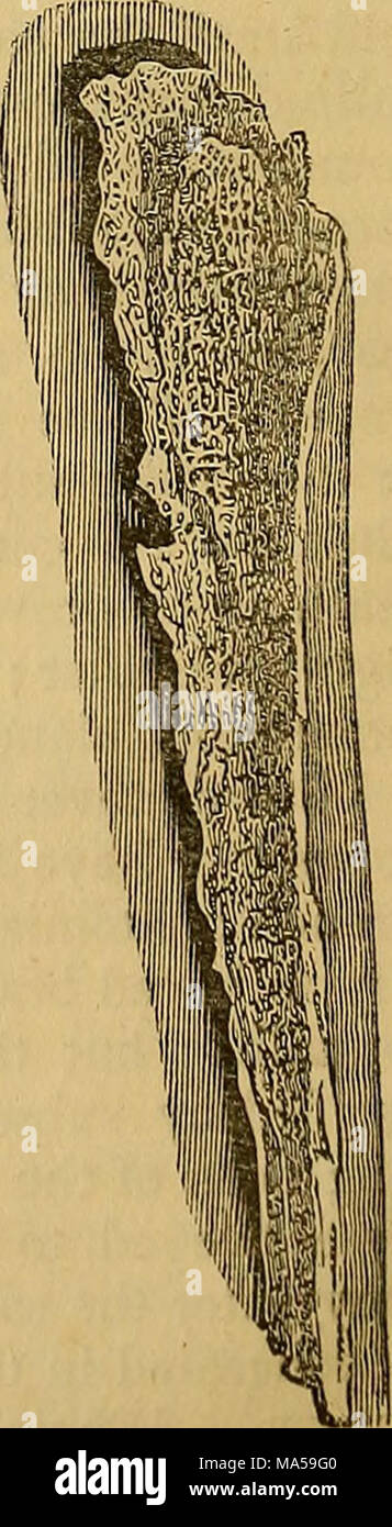 . Elements of pathological anatomy Stock Photo - Alamy