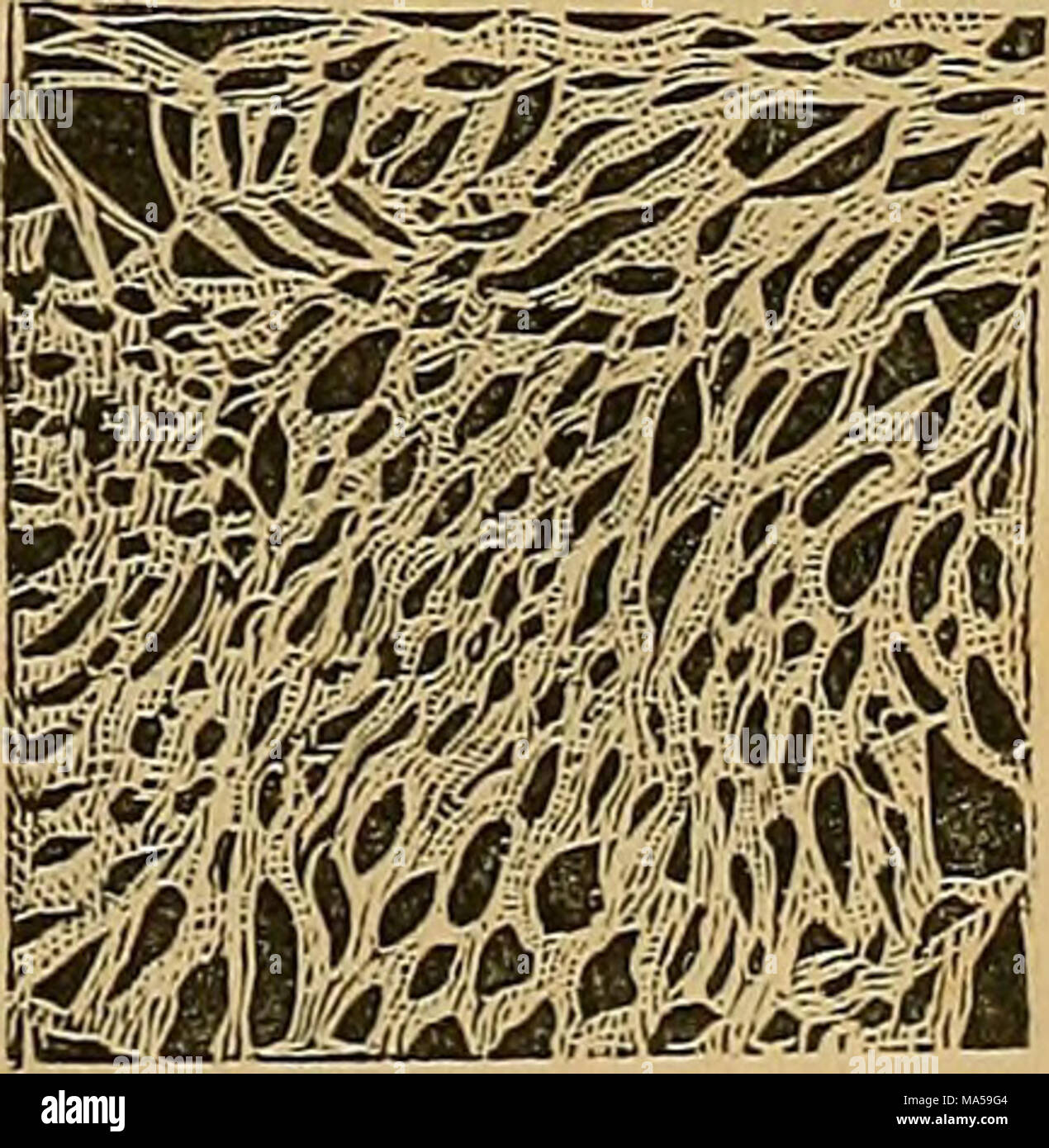 . Elements of pathological anatomy Stock Photo - Alamy