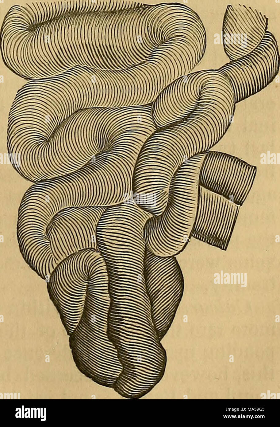 . Elements of pathological anatomy Stock Photo - Alamy