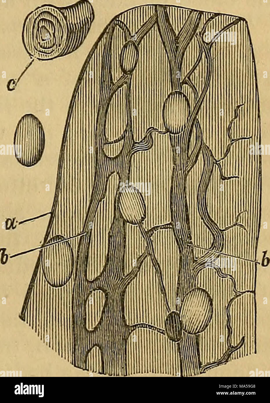 . Elements of pathological anatomy Stock Photo - Alamy