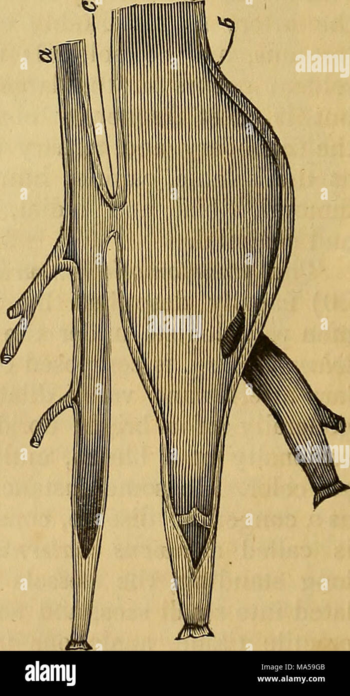 . Elements of pathological anatomy Stock Photo - Alamy