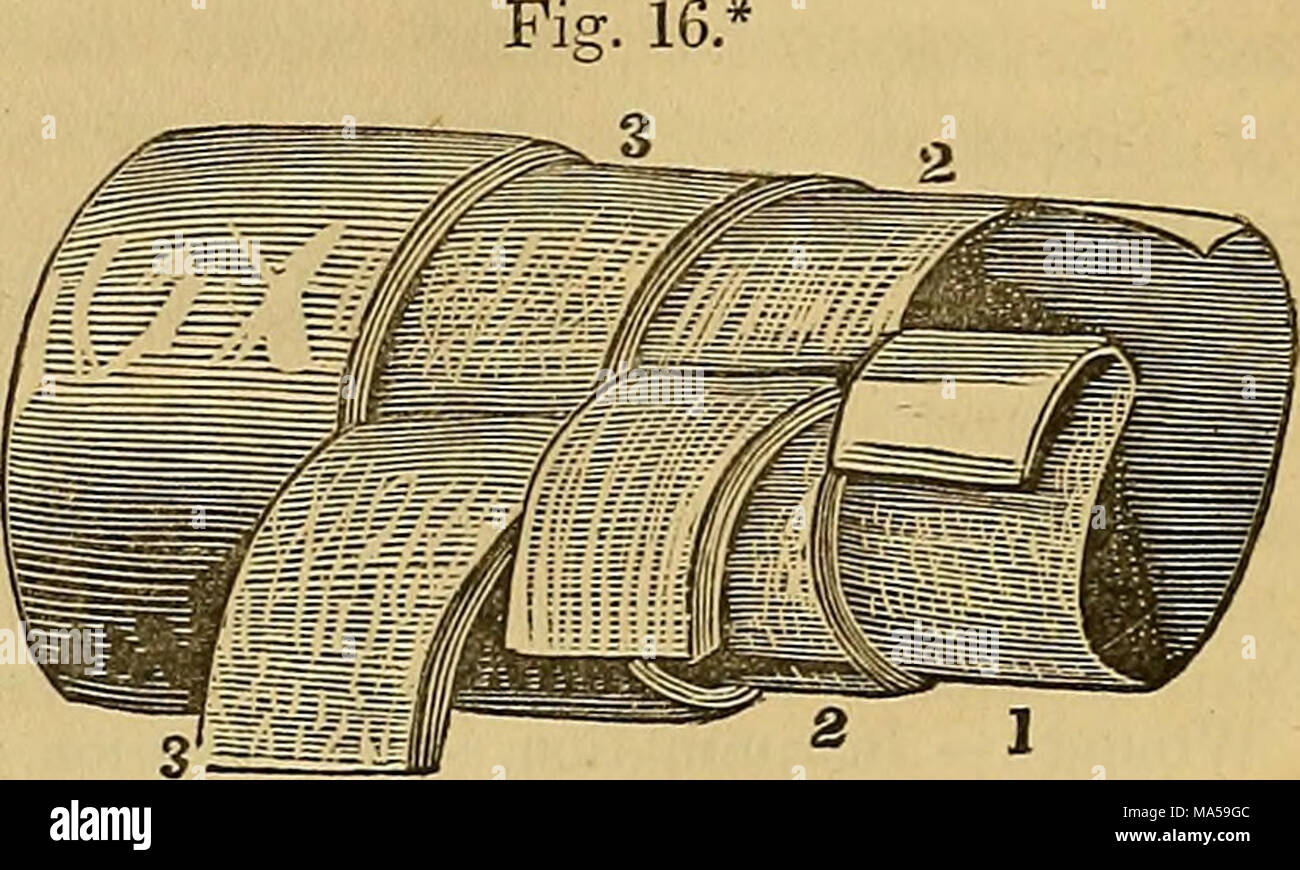 . Elements of pathological anatomy Stock Photo - Alamy