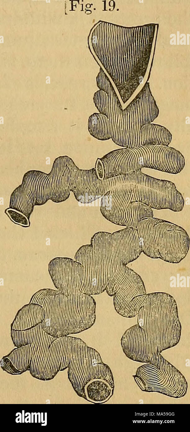 . Elements of pathological anatomy Stock Photo - Alamy