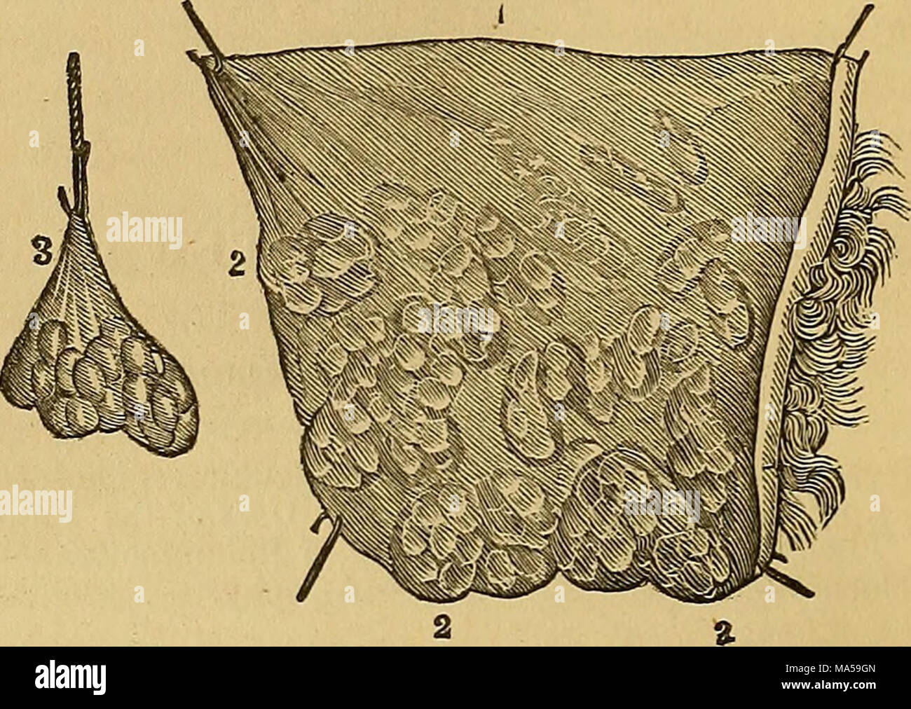 . Elements of pathological anatomy Stock Photo - Alamy