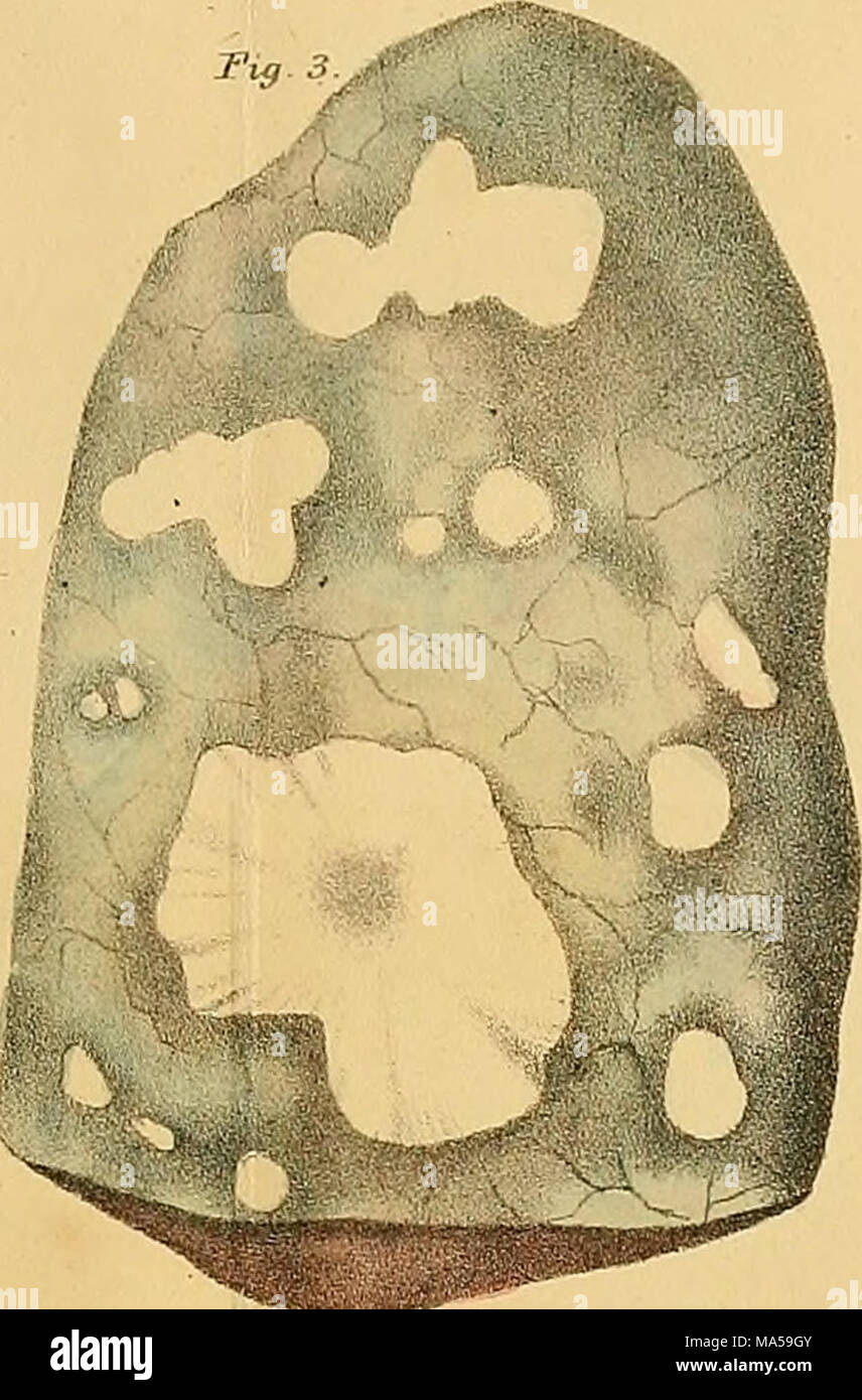 . Elements of pathological anatomy Stock Photo - Alamy