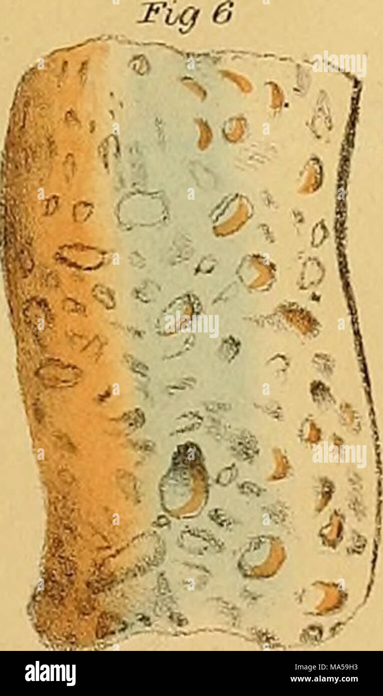 . Elements of pathological anatomy Stock Photo - Alamy