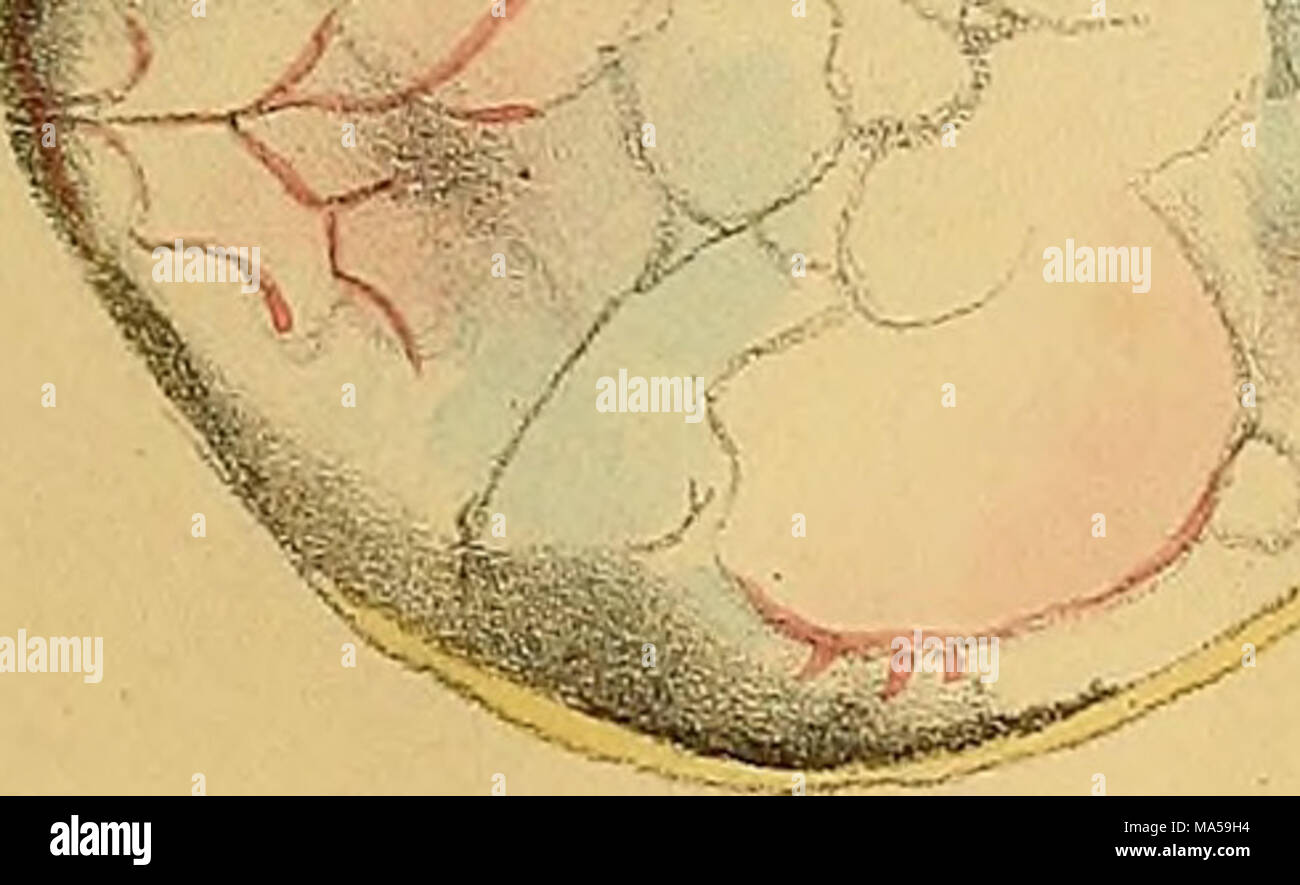 . Elements of pathological anatomy Stock Photo - Alamy