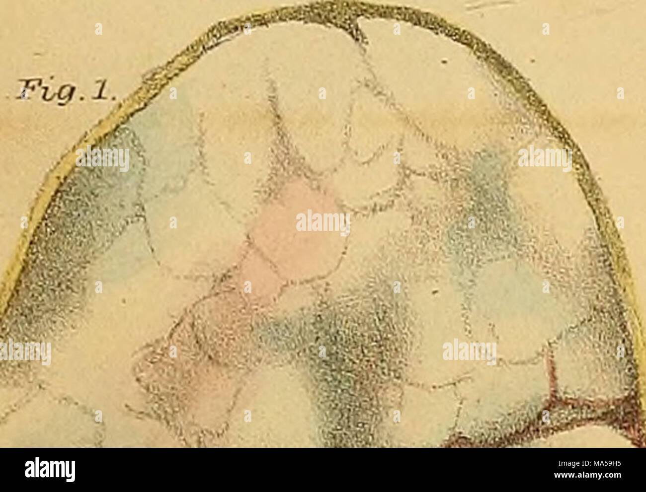 . Elements of pathological anatomy Stock Photo - Alamy