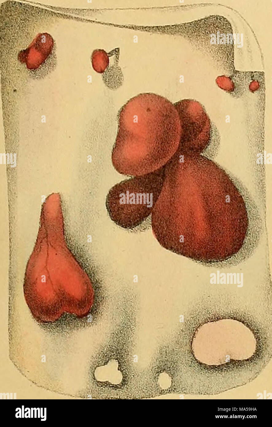 . Elements of pathological anatomy Stock Photo - Alamy