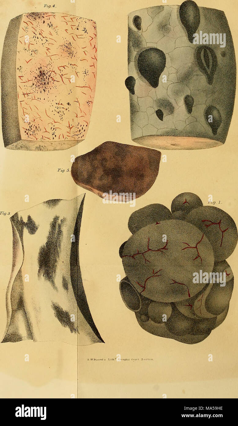 . Elements of pathological anatomy Stock Photo - Alamy