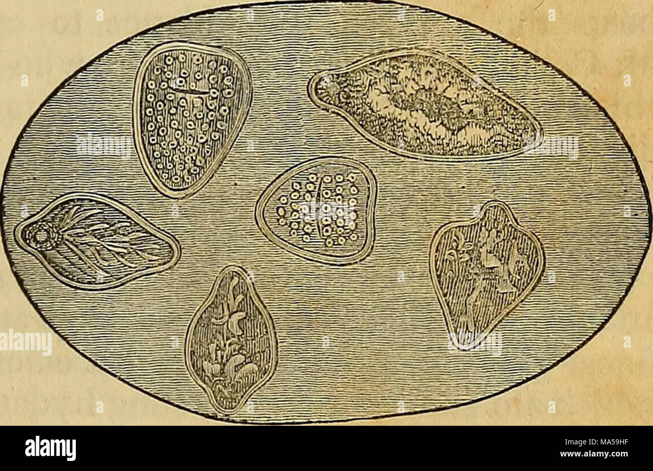 . Elements of pathological anatomy Stock Photo - Alamy