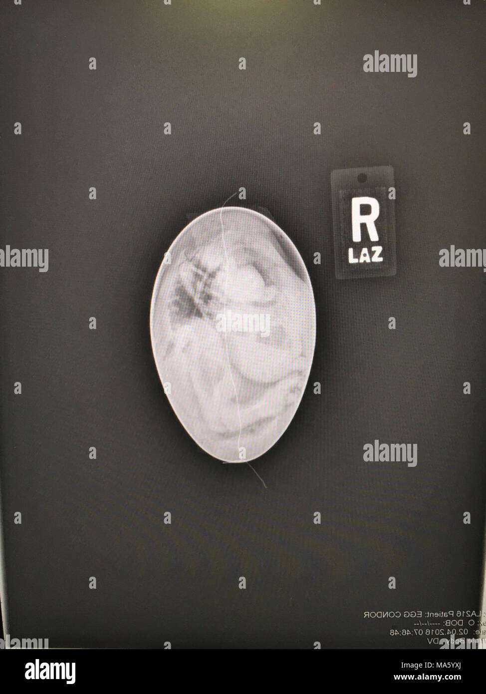 X-ray view of inside California condor egg 216 Stock Photo - Alamy